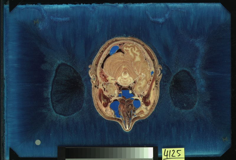 The Visible Human Project: Life and death in cyberspace - Artlink